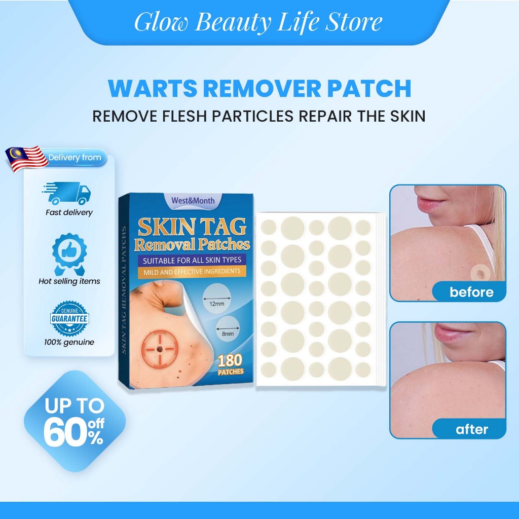Warts Remover Patch 180pcs Skin Tag Removal Patches Acne Warts ...