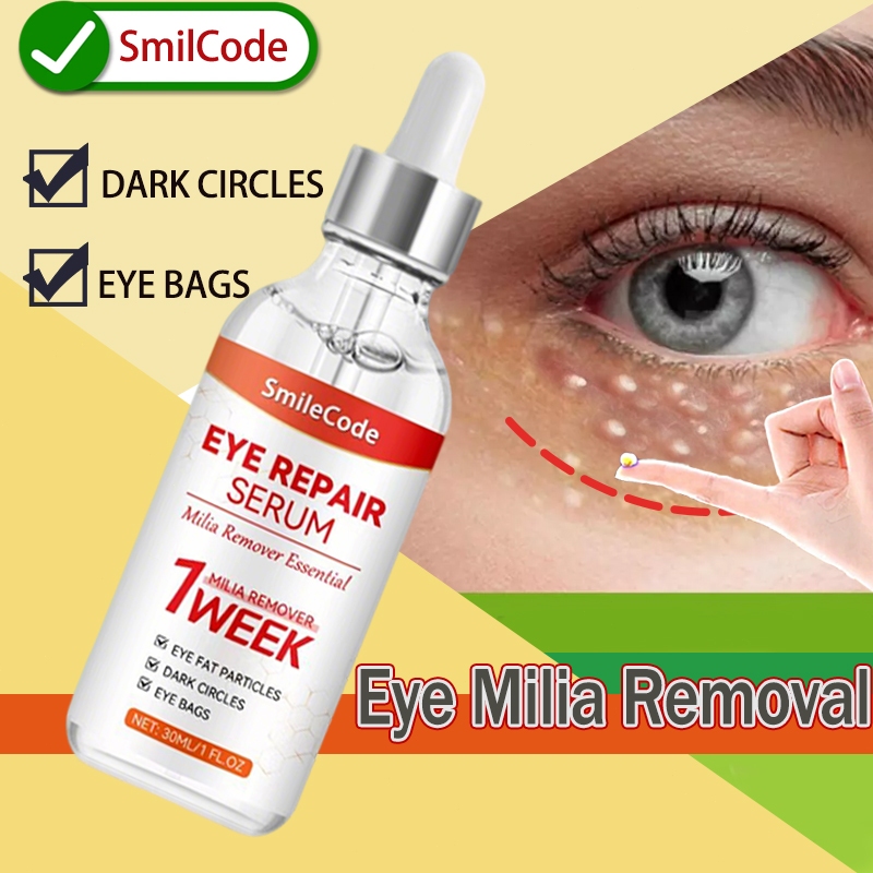 Fat Granule Remover Milia Seed Remover Syringoma Milia Reemover Grease ...