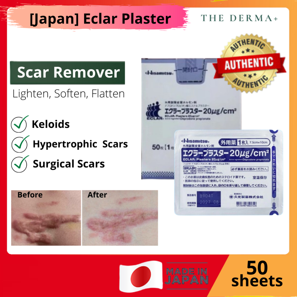 [Japan] Scar Removal / Keloid Treatment - Hisamitsu Eclar Plaster 日本久光 ...