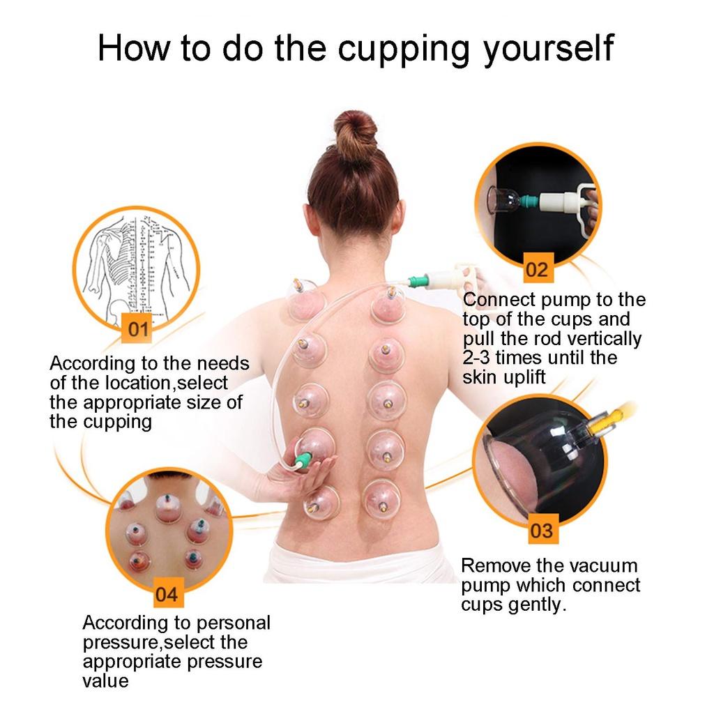 12/32pcs Cupping Set Bekam Bekam 拔罐器 Cup Pakai Buang Bekam Therapy ...