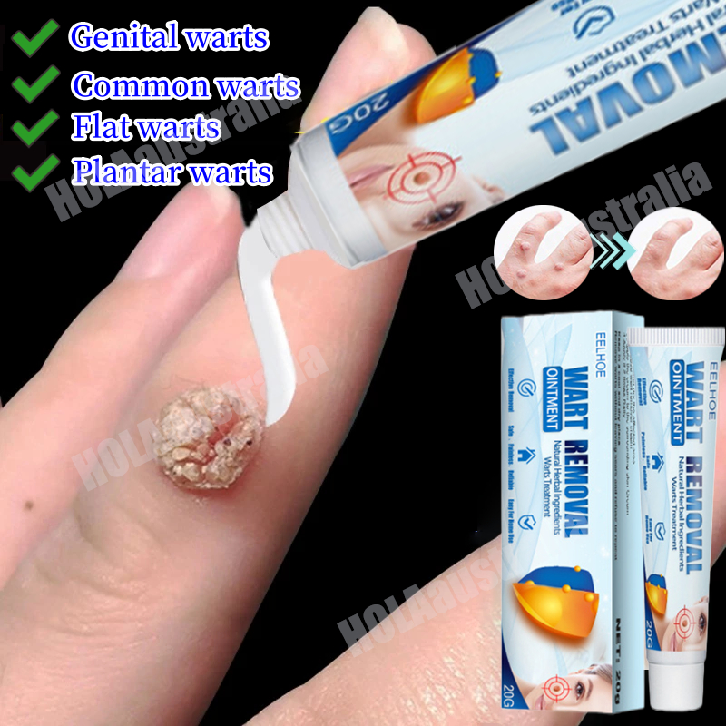 Wart Remover Ointment - Effective Cream for Removing Warts, Skin Tags ...