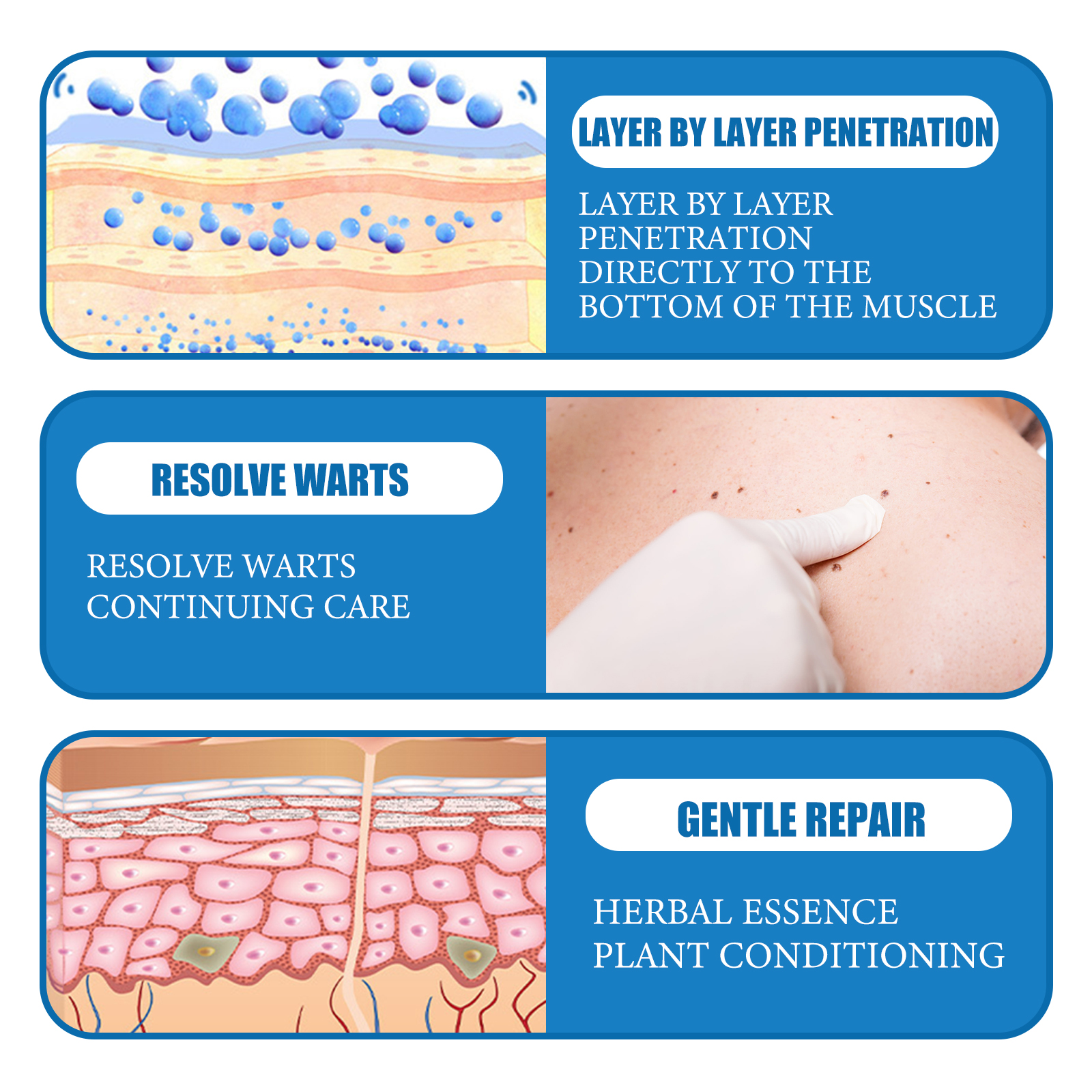 Wart Removal Patches 180PCS skin tag remover patch wart removal skin ...