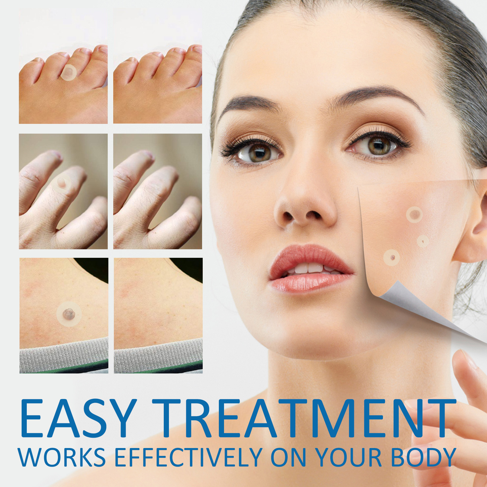 Wart Removal Patches 180PCS skin tag remover patch wart removal skin ...