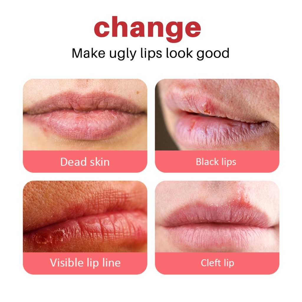Black Lip Lightening Lip Balm Remove Dull Black Lip Products ...