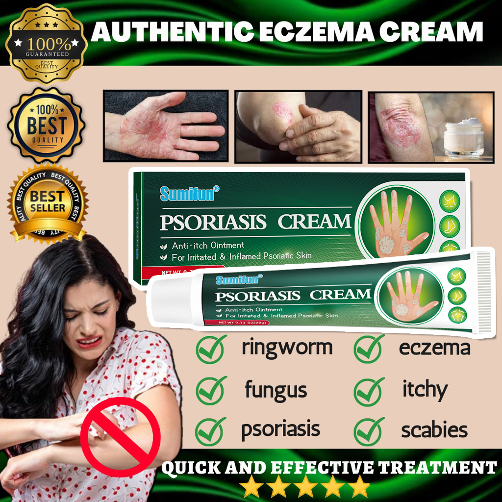 100% Effective Psoriasis Ointment Herbal Eczema Treatment Cream Anti ...