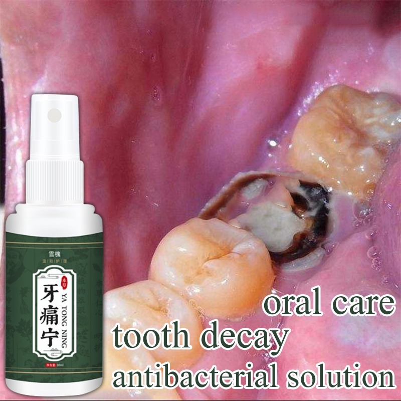 toothache pain relief spray tooth pain toothache reliever 30ml solve ...