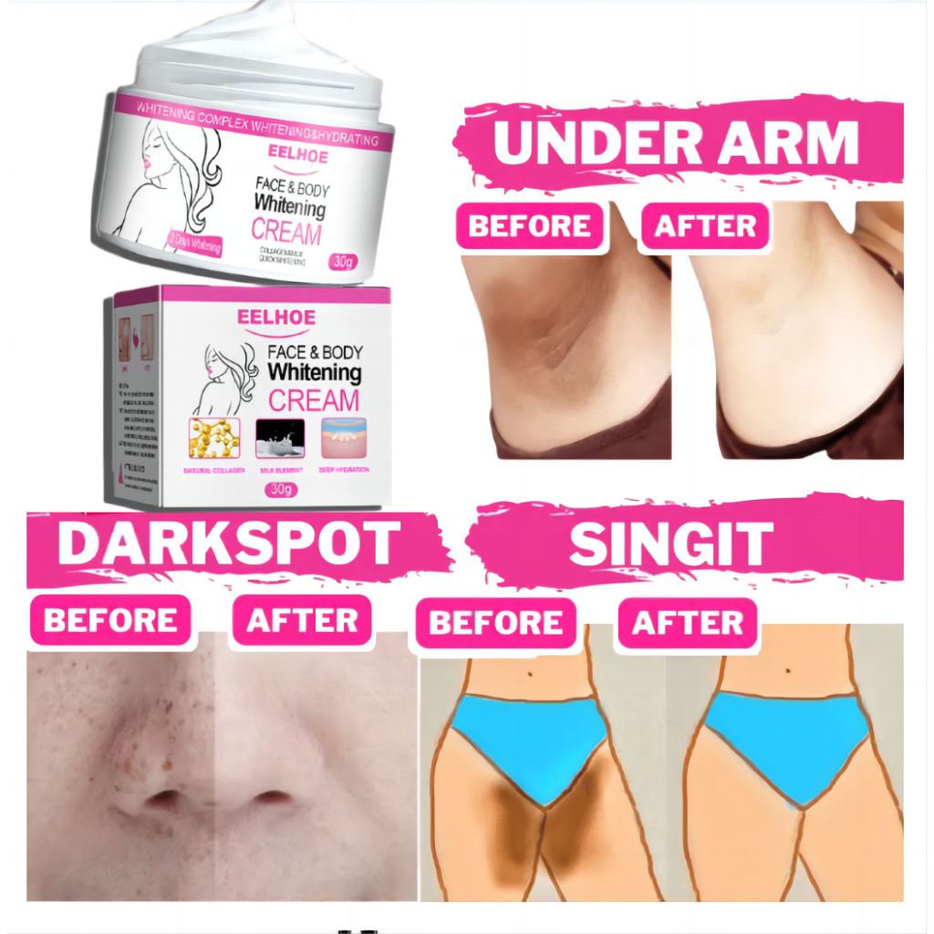 Effective Dark Spot Whitening Cream Private Parts Skin Underarm Whitening 30g pampaputi ng ...