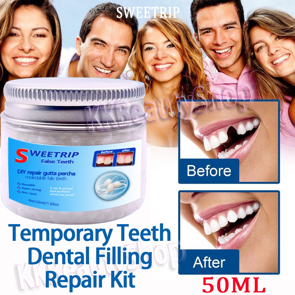 SWEETRIP 50g Temporary Tooth Repair Kit Temporary Teeth Replacement ...