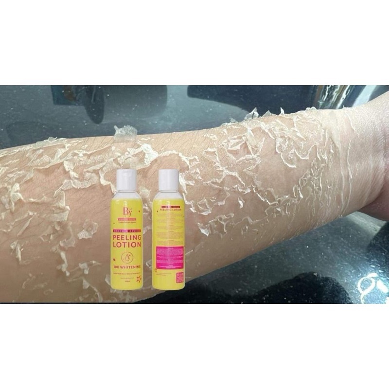 BRIGHTEST SKIN YELLOW PEELING LOTION 100ML | Shopee Singapore