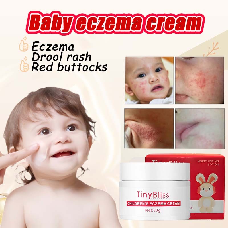 baby cream for rashes Dermatitispimplesrashred bottom/skin ulcers baby ...