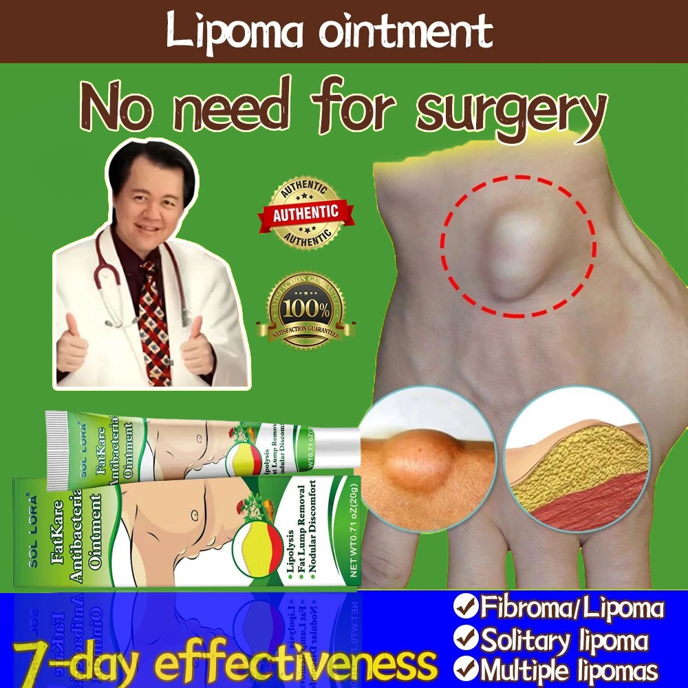 Fast Effect Lipoma Removal Cream Treat Tumor Skin Swelling Ointment ...