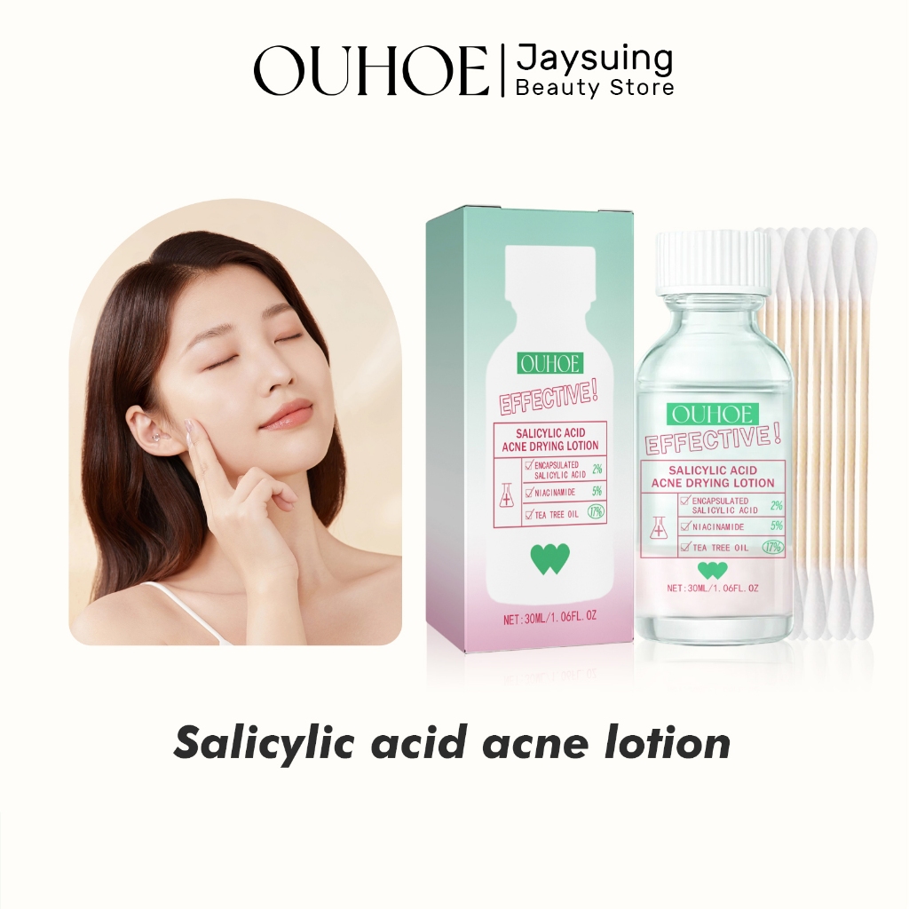 OUHOE Salicylic Acid Drying Lotion Gently Repair Acne-Prone Muscles ...