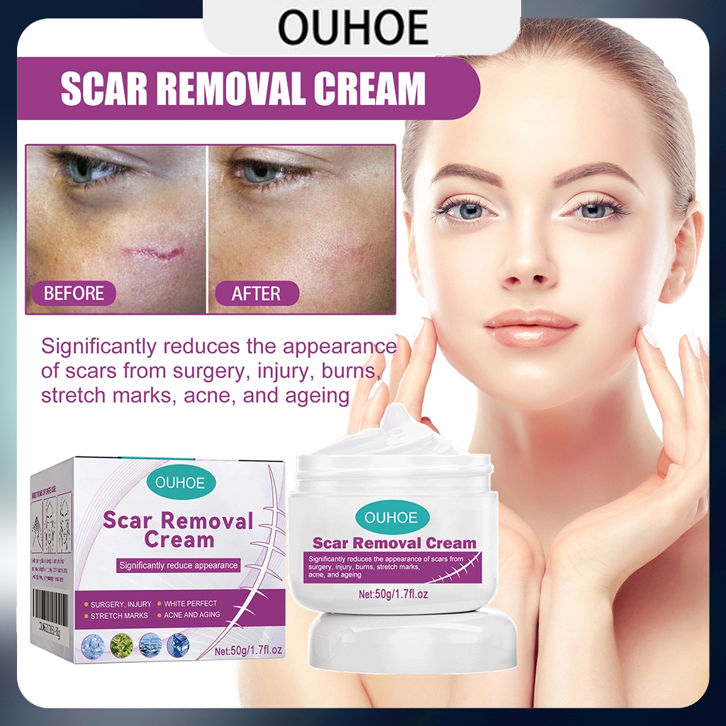 OUHOE Scar Repair Cream Gentle Nourishing & Lubricating Skin ...
