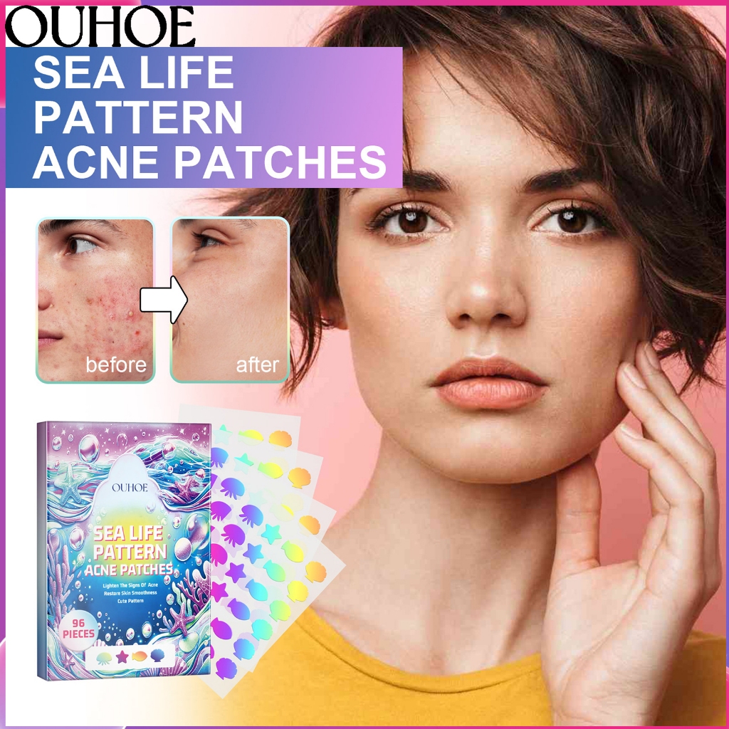 OUHOE Cute colorful acne patches 96pcs Cute Colorful Pimple Acne Sea ...