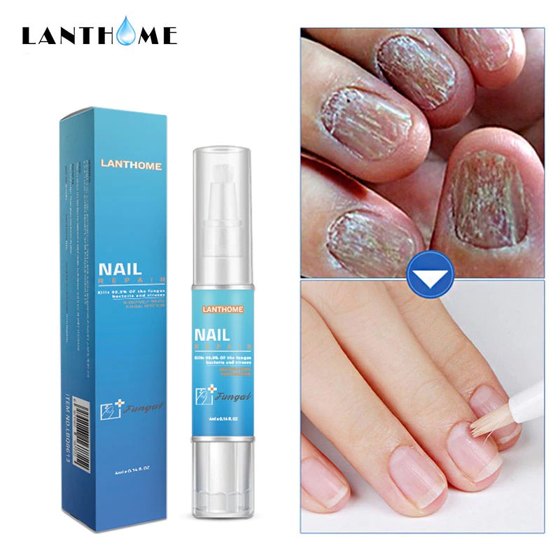 Anti Fungal Nail Treatment Nail Repair Pen Onychomycosis Paronychia ...