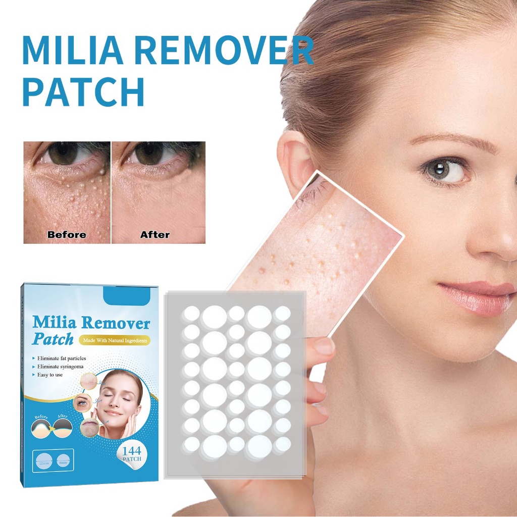 144pcs Milia Remover Patches for Milia Spot Treatment Soften skin ...