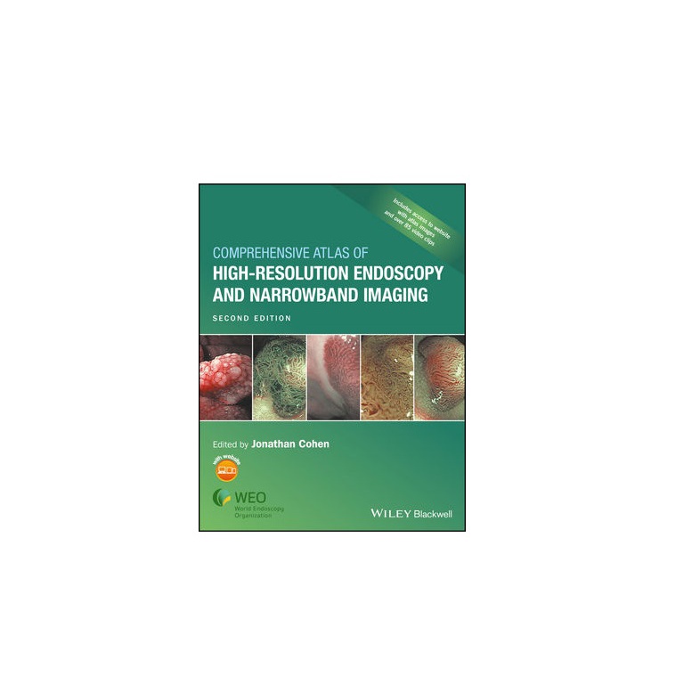 Comprehensive Atlas Of High Resolution Endoscopy And Narrowband Imaging ...