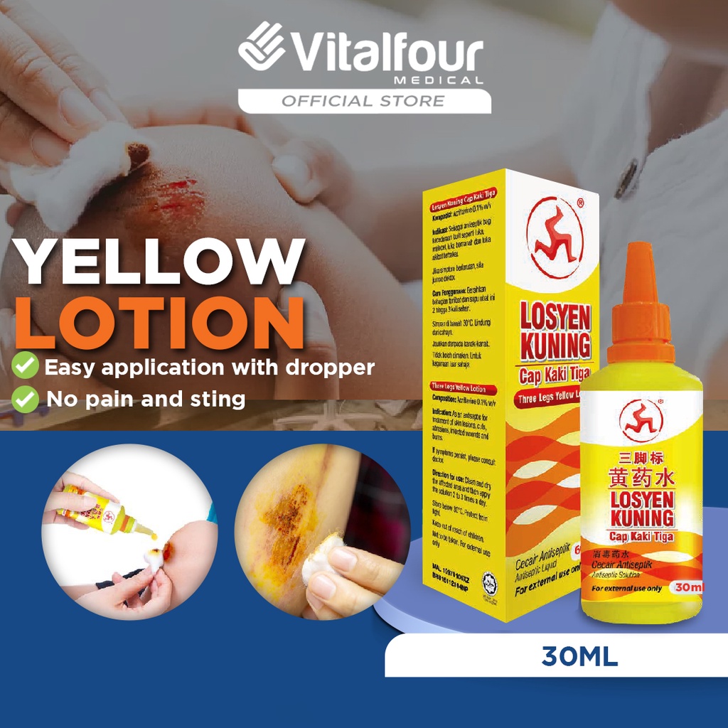 Yellow Lotion/Acriflavine Solution (30ml) | Shopee Singapore