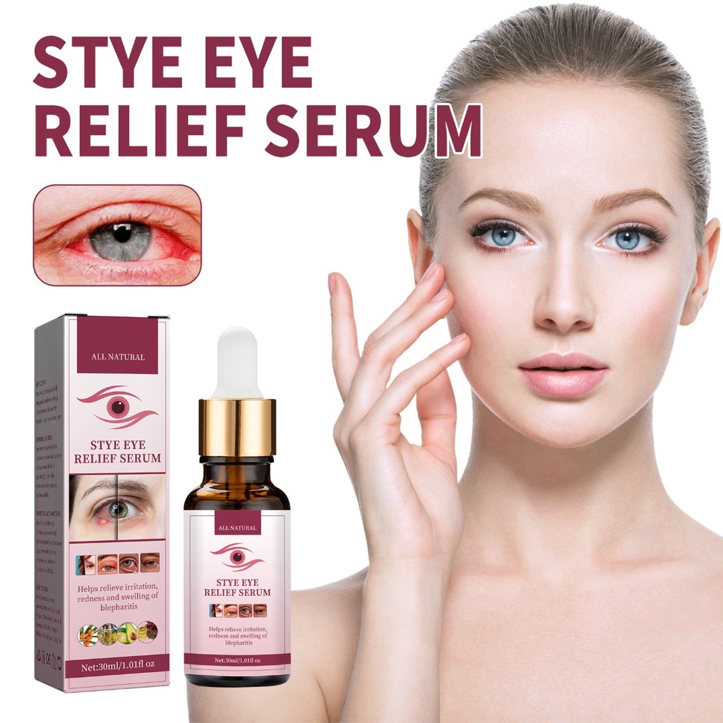 Stye Eye Relief Serum for Styes Chalazion Blepharitis Treatment Gentle ...