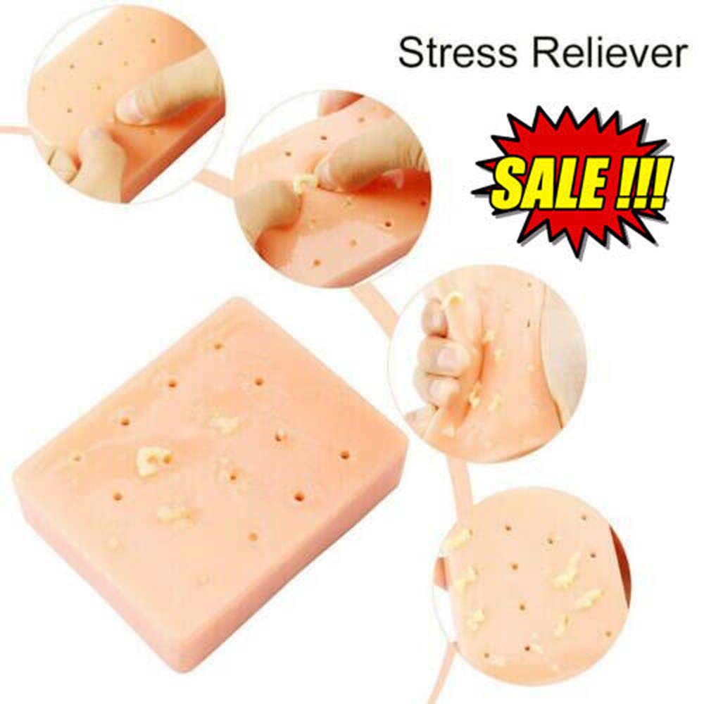 Acne Toys Squeeze Luminous Pimple Popping Popper Remover Stop Stress ...