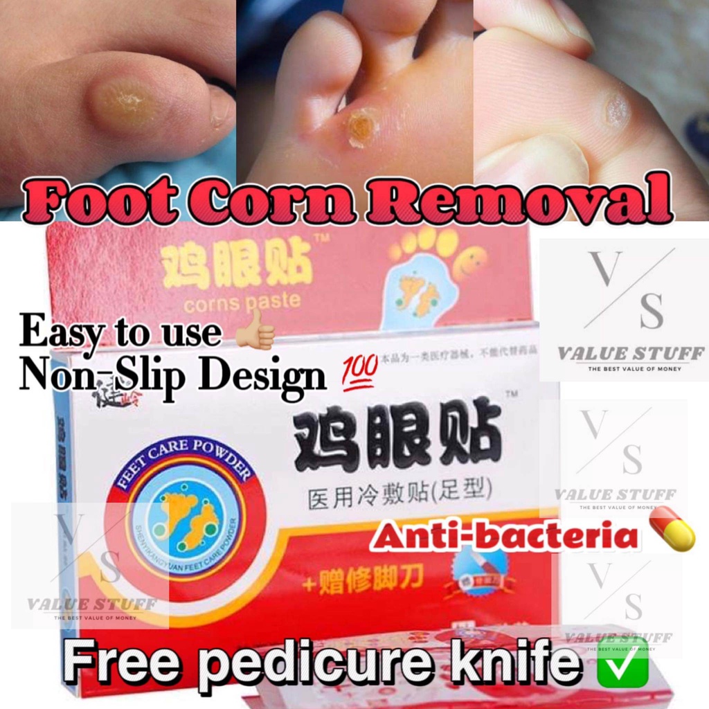 Free Pedicure Knife Foot Warts Corn Caps Remover Cream Plaster Patch ...
