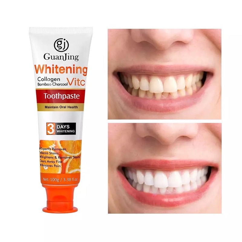 Deep Cleaning Vitamin C Collagen Teeth Whitening Toothpaste 100 Gram ...