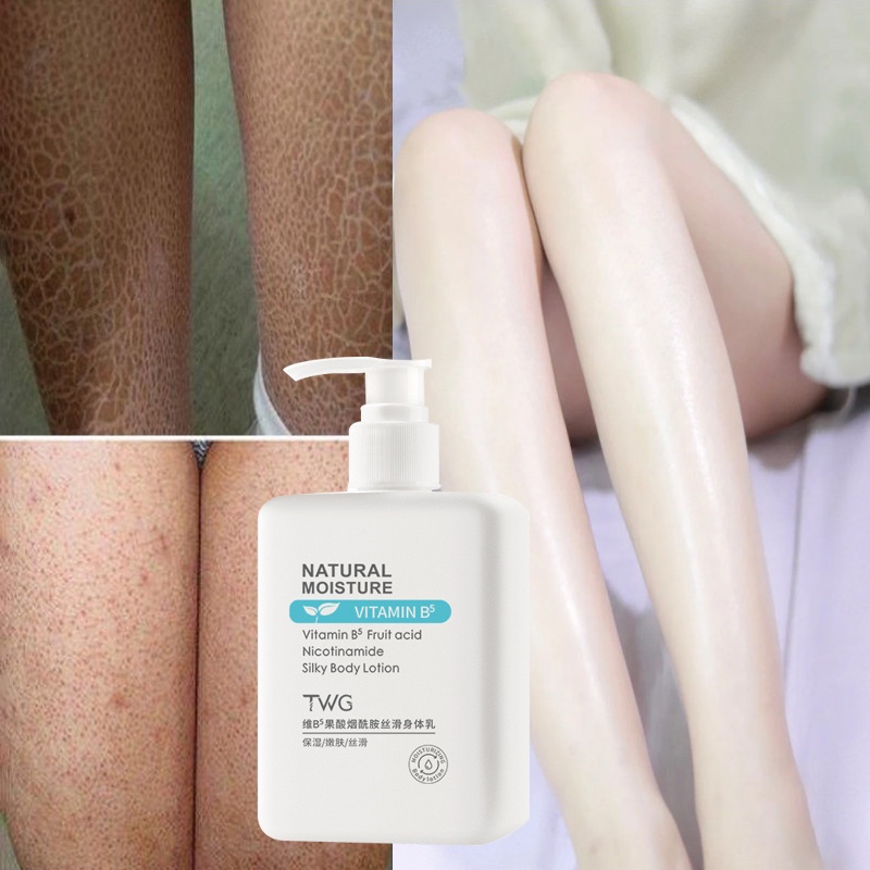 Body Whitening Cream Nicotinamide 300ml Moisturizing Skin Whitening ...