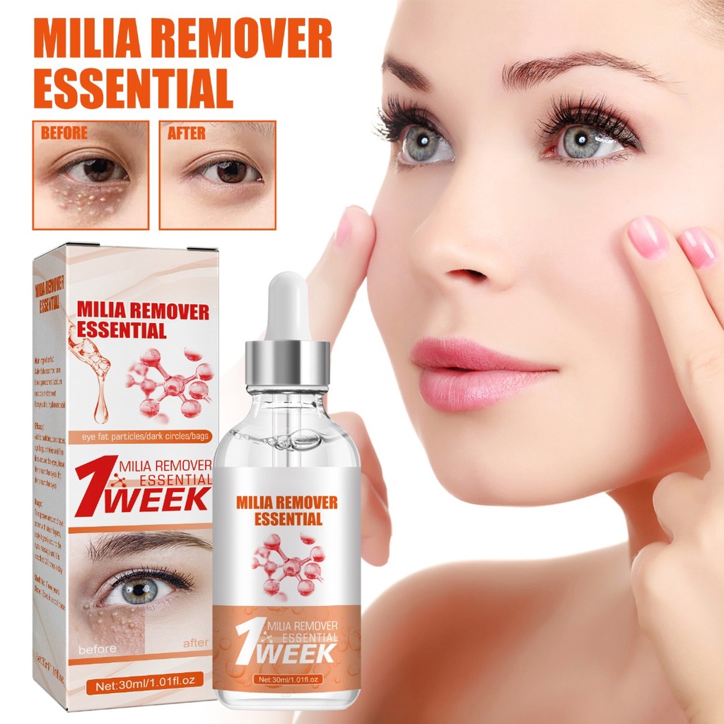 30ml Milia Remover Essence Milia Spot Treatment Helps Dissolve and ...