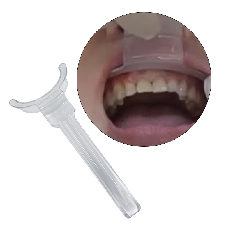 High Quality Upper and Lower Lip Retractor Lip Retractor Intraoral ...