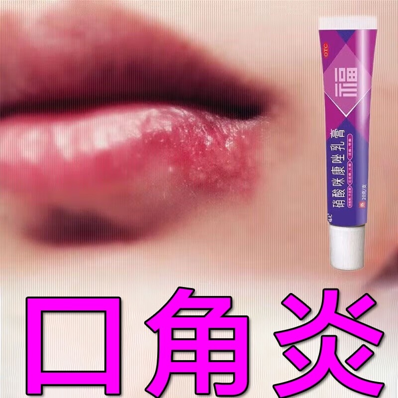 Angular Stomatitis Ointment Miconazole Nitrate Emulsifiable Paste Mouth ...