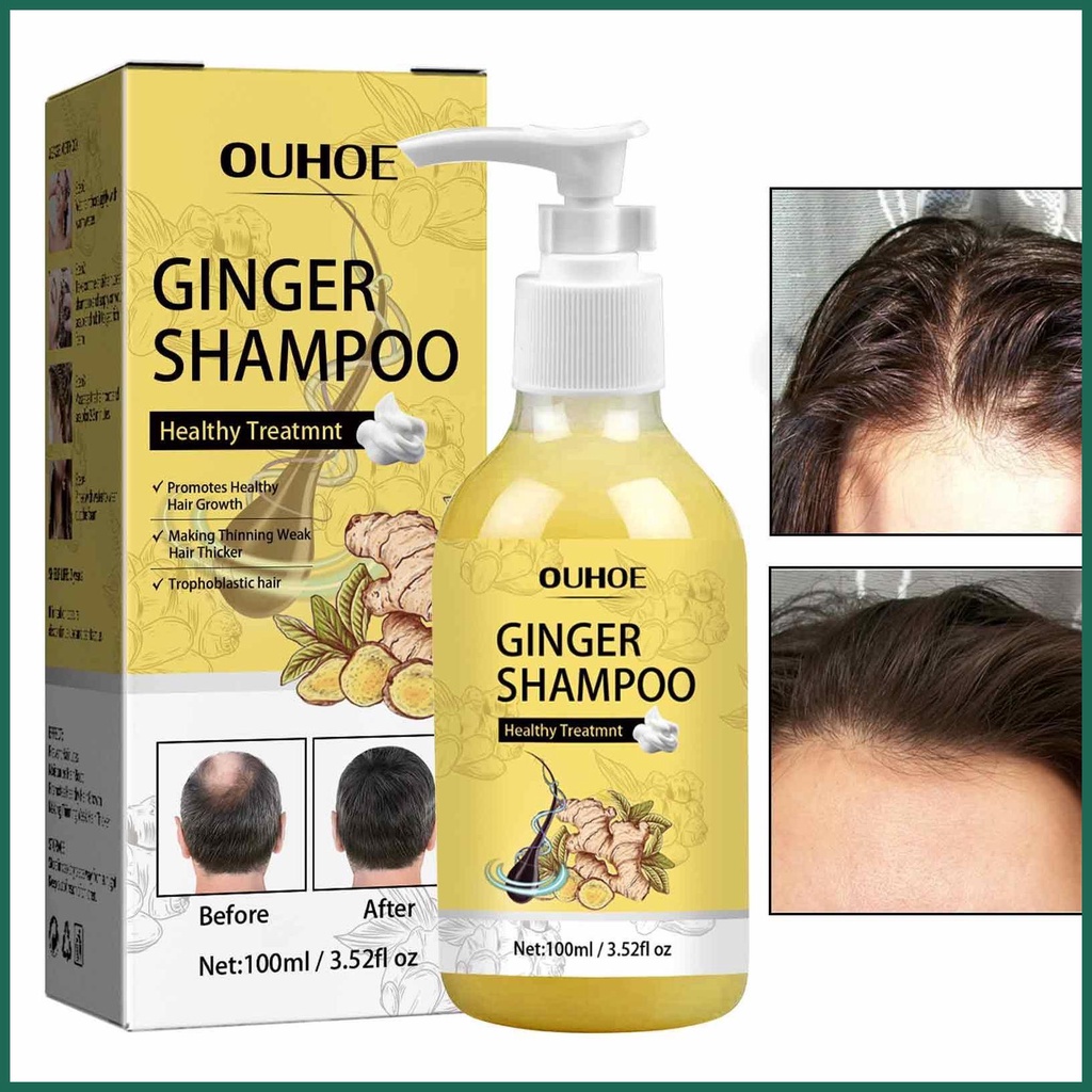 Organic Ginger Shampoo Anti Hair Reduction Shampoos For Men Mild
