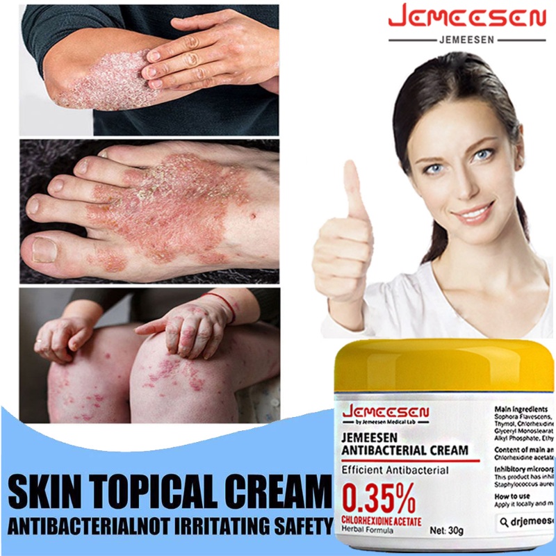 Psoriasis Cream Dermatitis Eczematoid Eczema Pruritus Ointment
