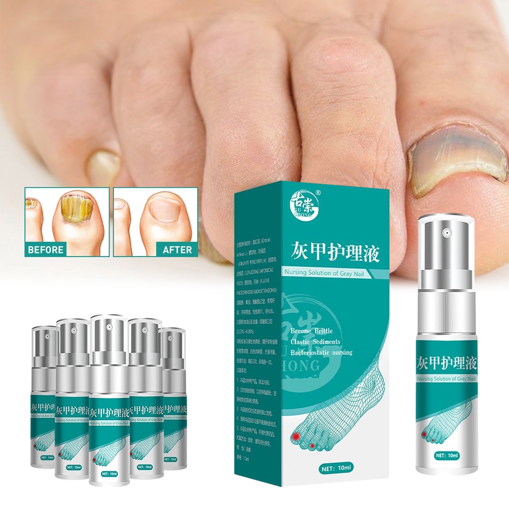 Extra Strength Toenail Fungus Treatment for Toenail Nail Repair ...