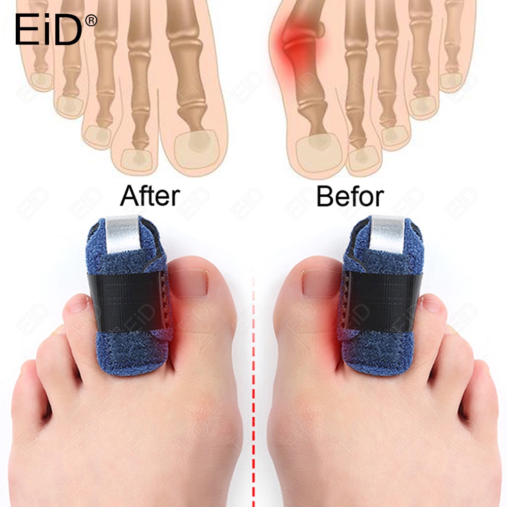 EiD Toe Splint Toe Straightener Toe Wrap for Hammertoe Bent Claw and ...