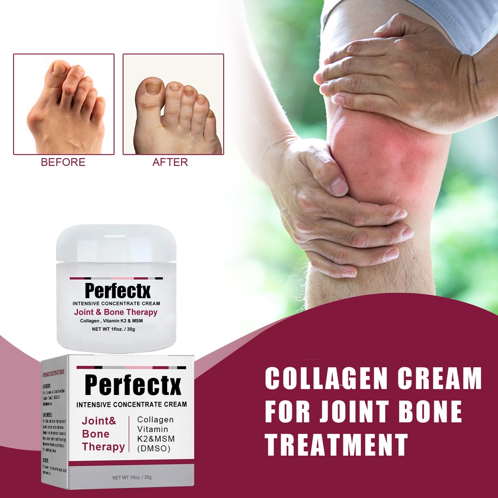 Perfectx Joint & Bone Therapy Cream, Natural Joint & Bone Therapy Cream ...
