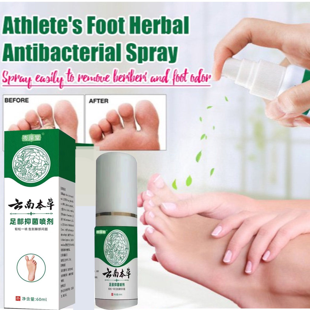 Athlete's Foot Treatment Spray Cures Foot Between Toes Rapid Symptom ...