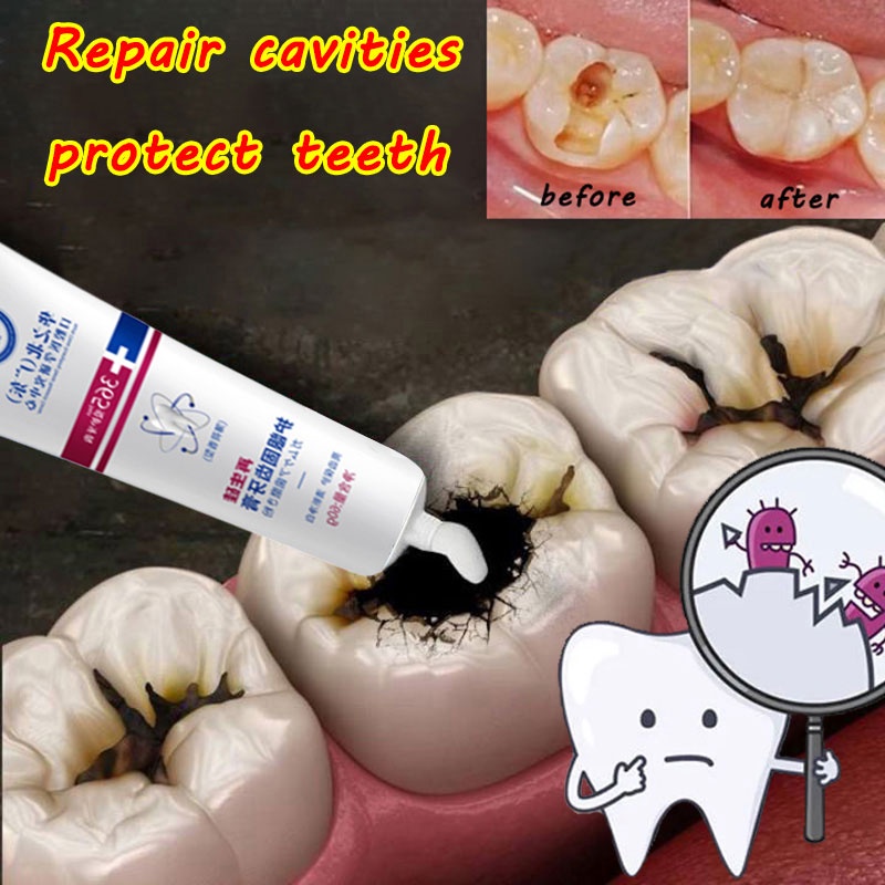 Quickly Repair Toothpaste Of Cavities Caries Whitening Toothpaste To ...