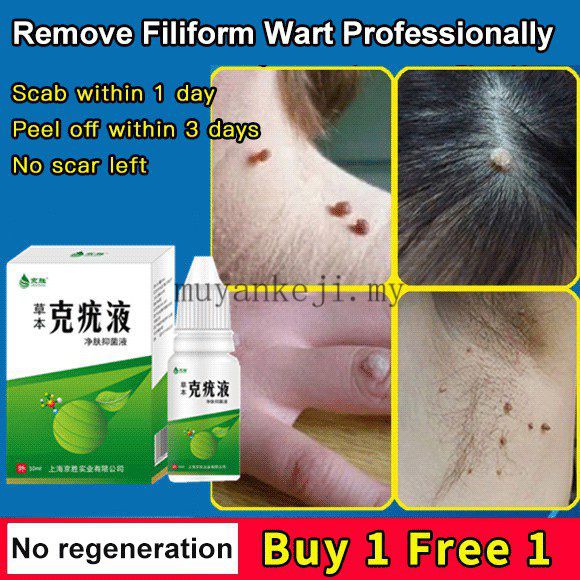 【IN STOCK】Herbal Wart Liquid Ke wart liquid to remove warts, pointed ...