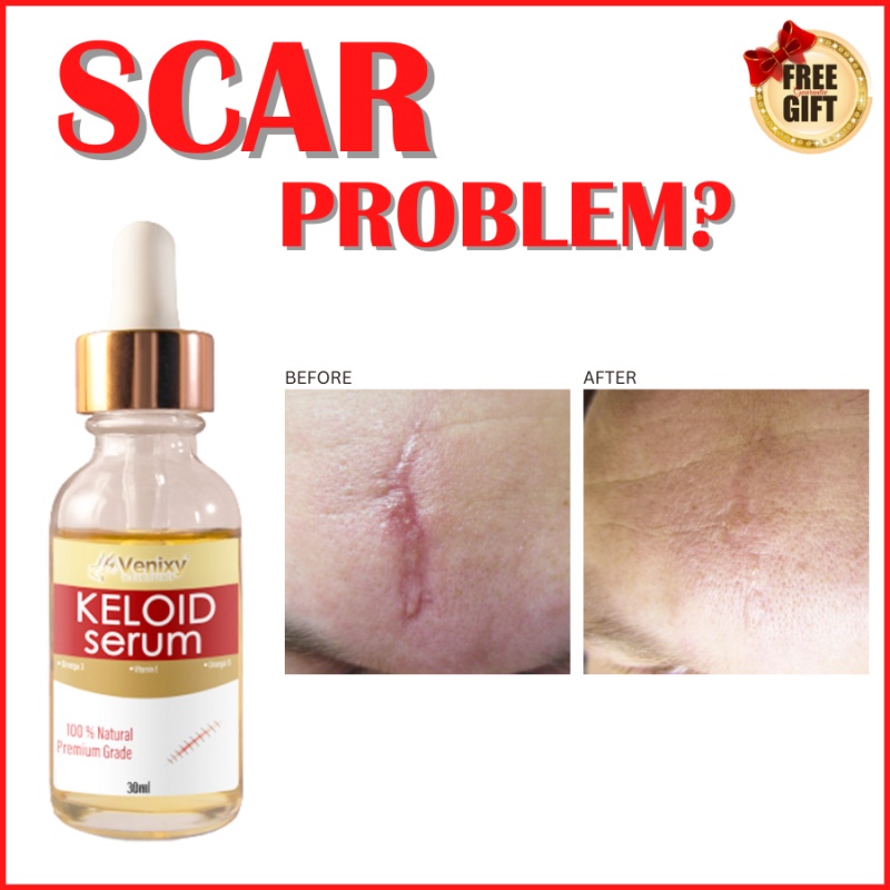 Scar Remover Keloid Serum Scar Remover Scar Original Dr Scar Remover