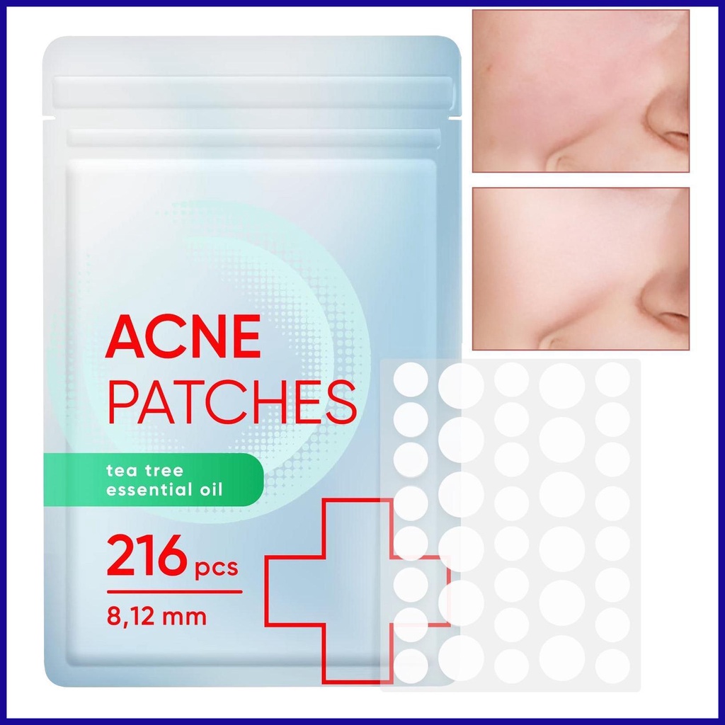Face Patches For Pimples Pimple Patch Blemish Care Patches Fast Acting ...