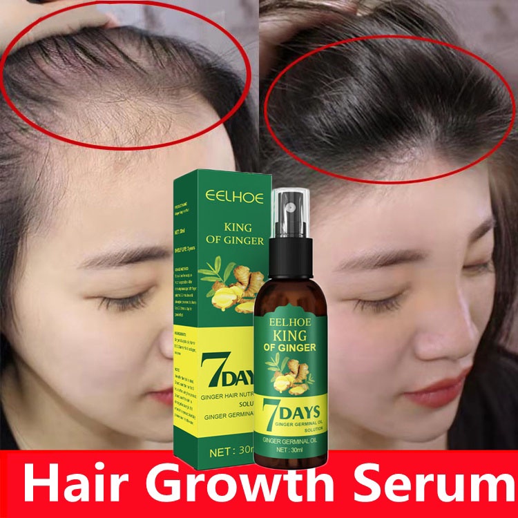 Ginger Hair Growth Spray Hair Care Germinal Oil Anti Hair Loss Hair