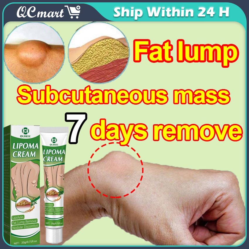 【Ship In 24H】 Lipoma Removal Cream Reduce Inflammation Anti Swelling ...