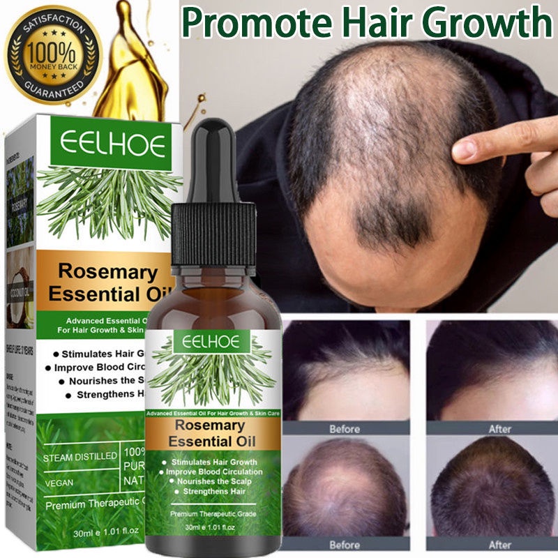 Original Rosemary Hair Growth Serum 30ML Fast Powerful Hair Grower ...