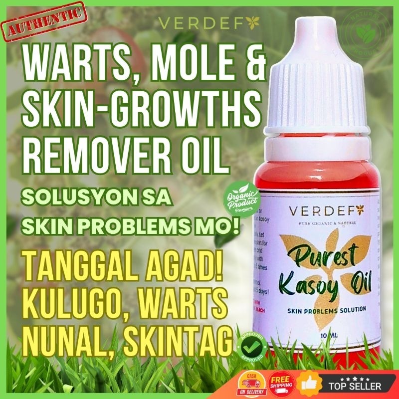AUTHENTIC ORIGINAL KULUGO SYRINGOMA SKIN TAGS WARTS GENITAL WARTS ...