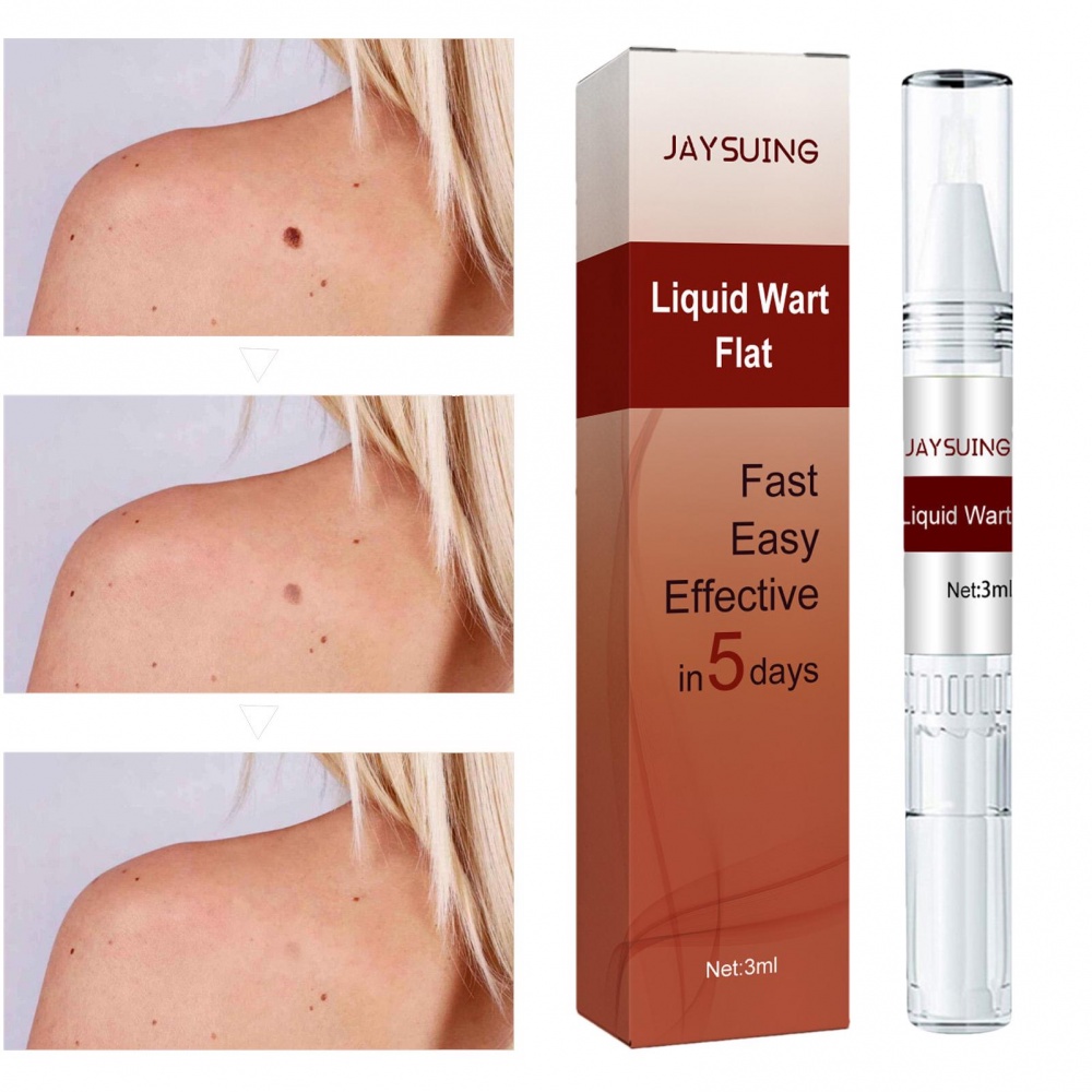 Wipeoff Tags & Moles Remover, Mole Removal, Natural Non-Irritating ...