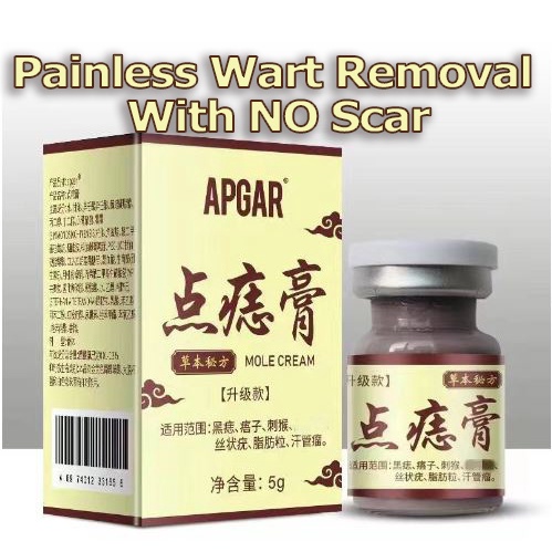 Cream Ubat Ketuat Wart Remover Skin Tag Remover Ubat Kutil Mole Remover ...