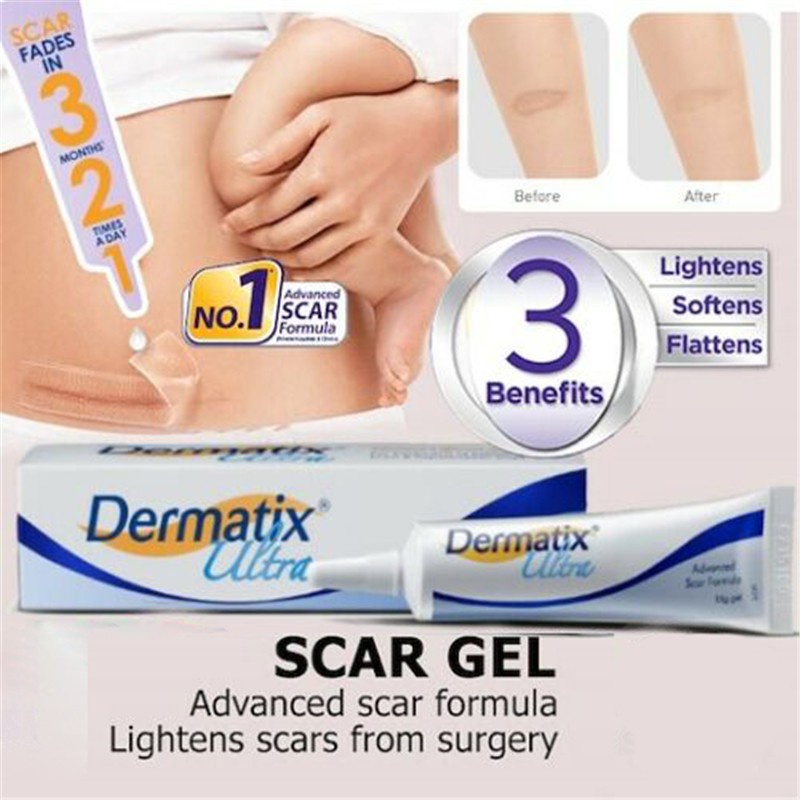 Dermatix ultra remover Scar Repair Cream Advance Scar Stretch Acne ...