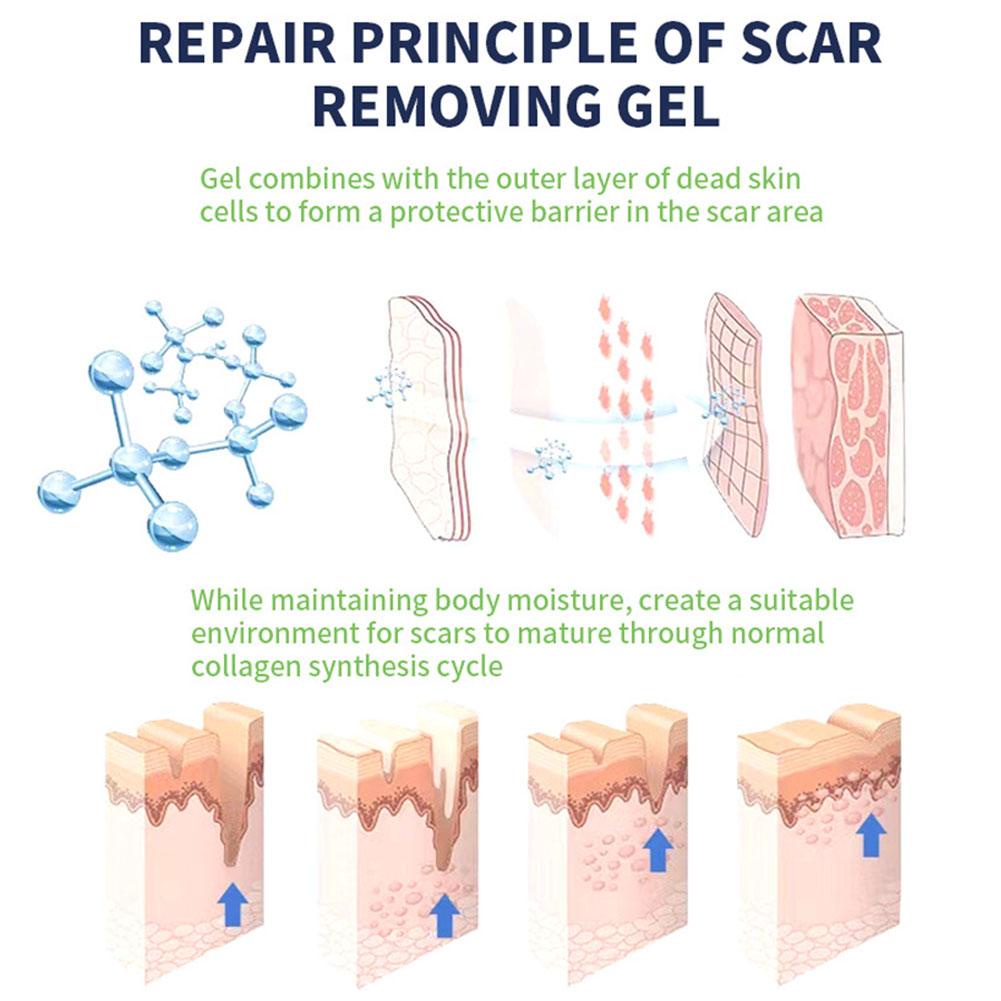 30g Silicone Scar Gel Skin Repair Cream Surgery Scar Gel Removal ...