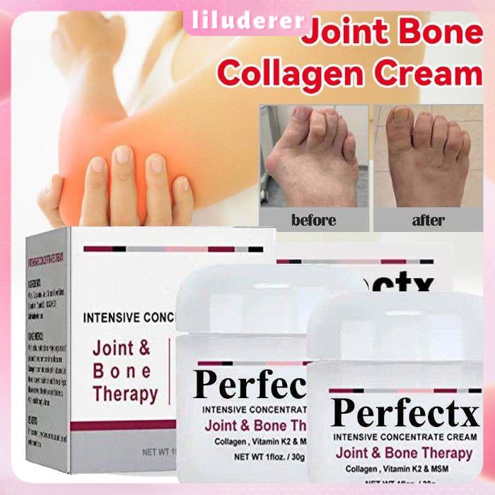 Perfectx 30g/box Joint And Bone Therapy Cream Treatment Gout Cream ...