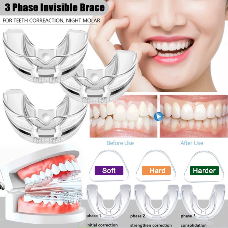 3pcs/set Tooth Orthodontic Appliance Trainer Dental Braces Teeth ...